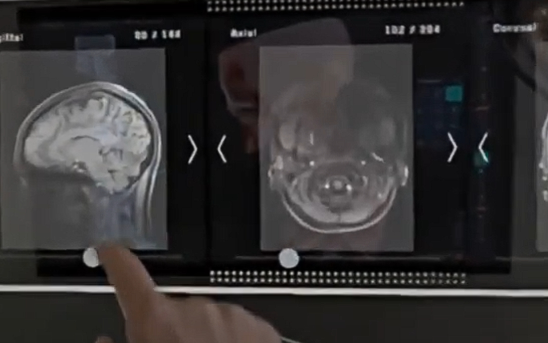 Apple Vision Pro Surgery Training - NipsApp Game Studios case study ...