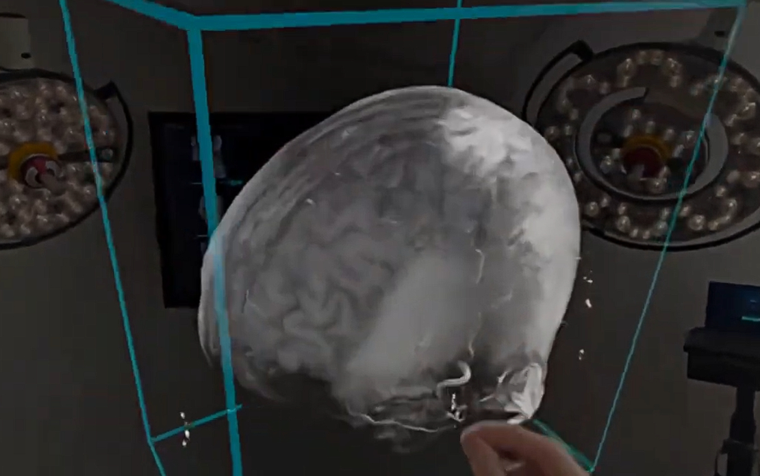 Apple Vision Pro Surgery Training - NipsApp Game Studios case study ...