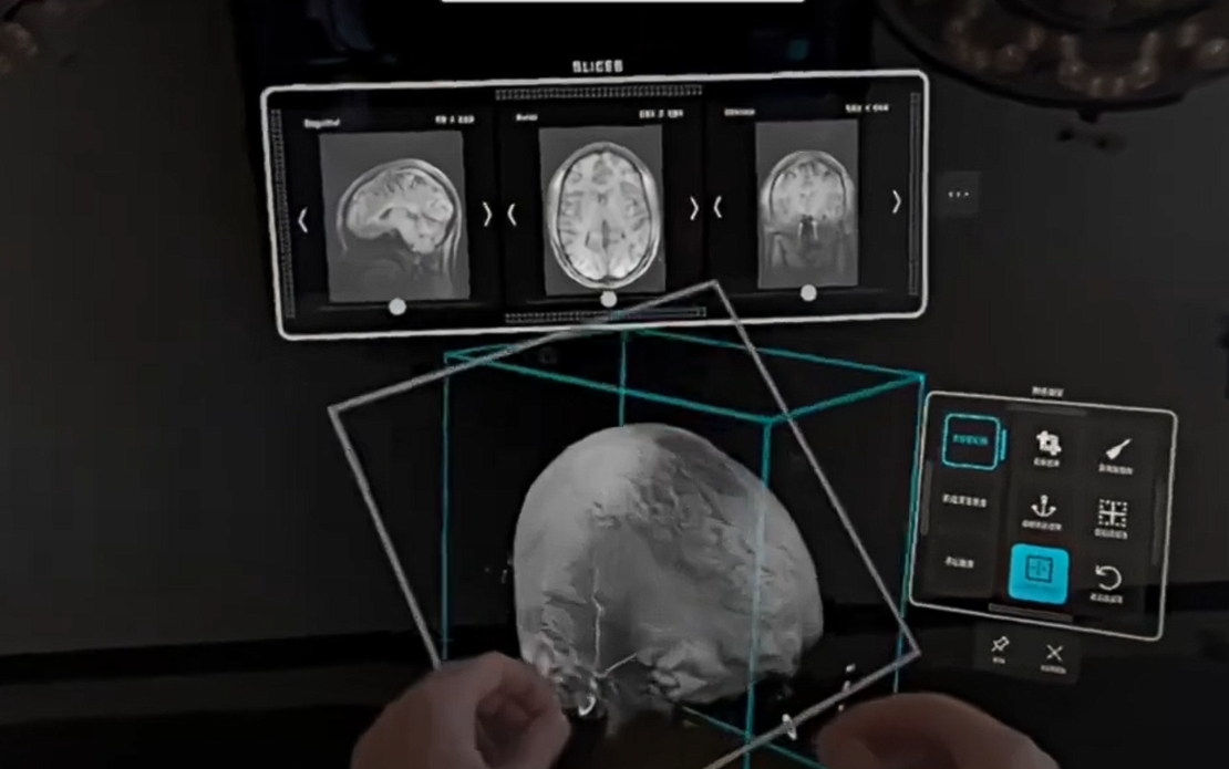 Apple Vision Pro Surgery Training - NipsApp Game Studios case study ...
